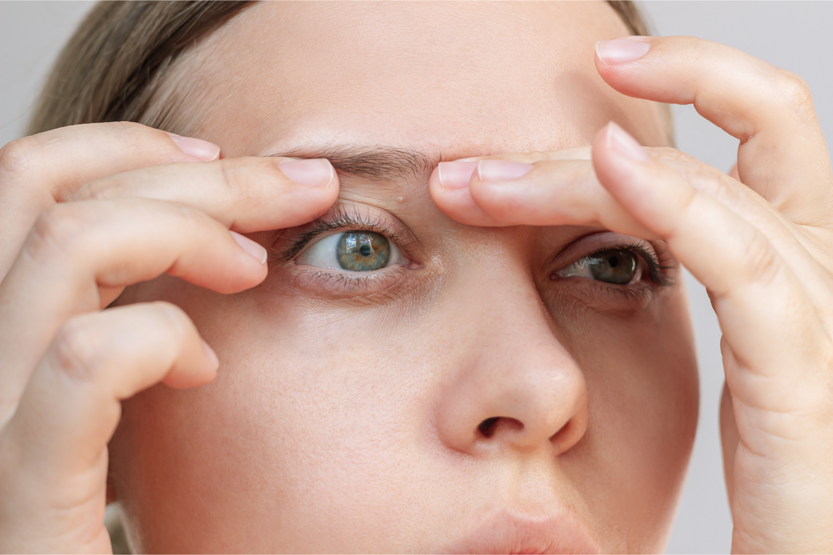 Eyelid Milia 101: Break It Down, Don’t Break the Barrier | Dermastart ...